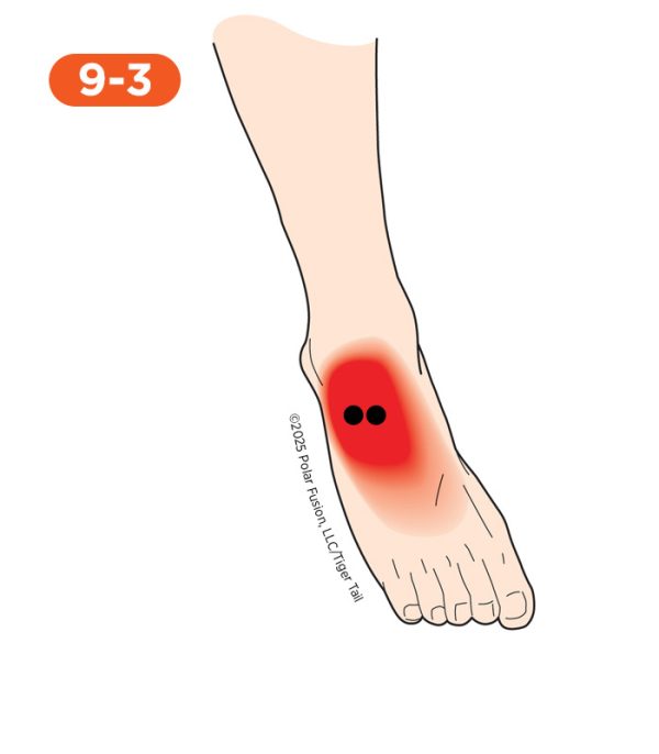 Pain by Muscle Names Extensor Digitorum Brevis | Tiger Tail USA